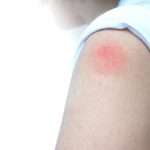 15 Hidden Damaging side effects of Laser Therapy : You Need to Know ...